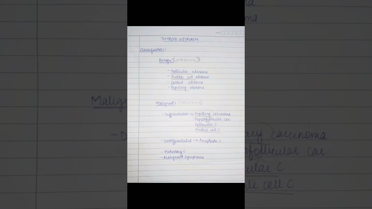 Thyroid neoplasm general surgery notes #bds #medical #gs #notes #thyroid