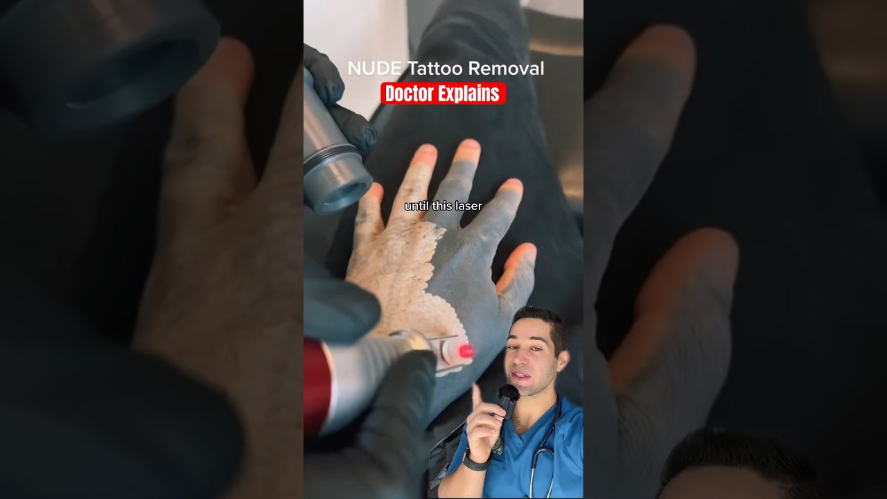 Doctor explains how tattoos are removed