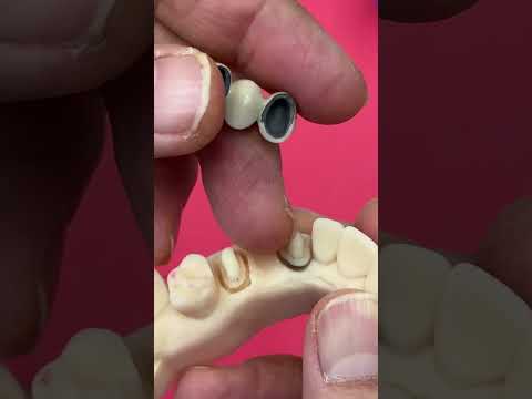 Old dental lab school techniques but still good! @EnvisiontecMain #envisiontec