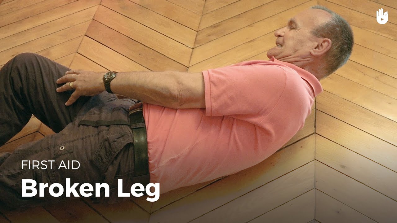 First Aid Broken Leg Learn How To Save A Life Sikana