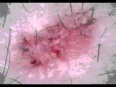Vascular Pattern 3/3 by Dr. Harald Kittler