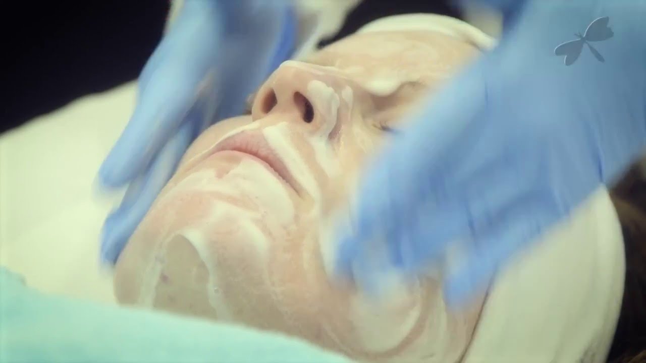 TCA Chemical Peel Skin Tech The Laser and Skin Clinic