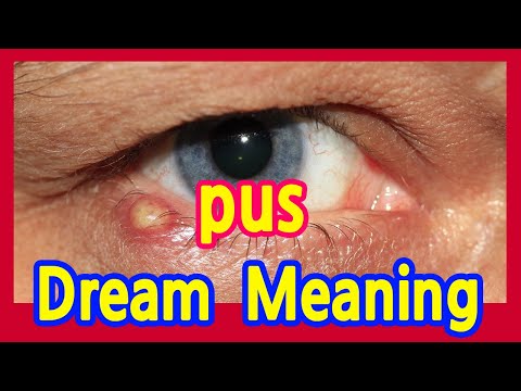 [Dream Meaning] 23 Perfect Interpretations of Dreams About Pus  Why Does Pus Appear in Dreams