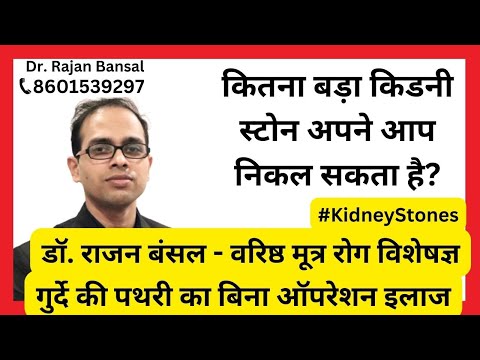 Kidney stone size you can pass at home | Non- Surgical Treatment of Kidney Stones | Dr. Rajan Bansal