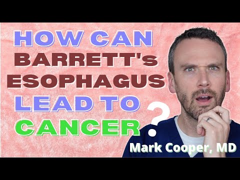 Barretts Esophagus