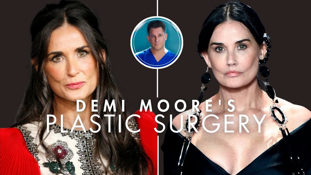 DEMI MOORE BEFORE AND AFTER: Beverly Hills Plastic Surgeon Explains What Happened