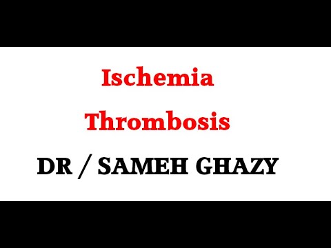 شرح GENERAL PATHOLOGY 36 ischaemia and thrombosis DR SAMEH GHAZY معتمد ...