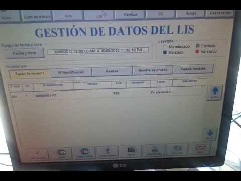 ANALIZADOR IMMULITE 1000