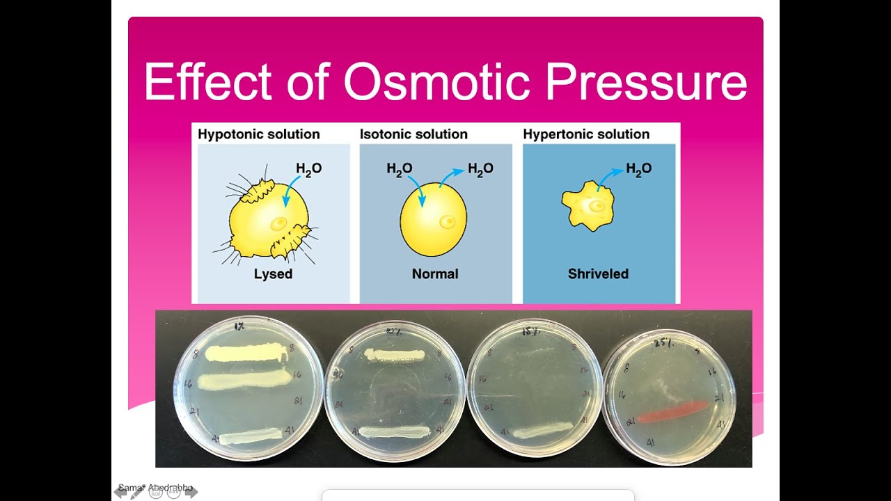 Effect of Osmotic Pressure Lab