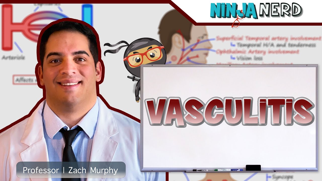 Vasculitis | Clinical Medicine
