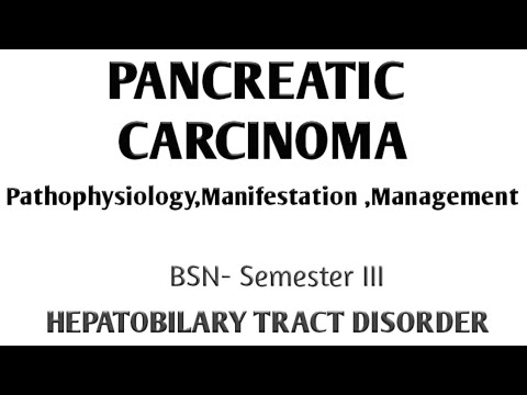 Pancreatic carcinoma in Urdu/Hindi - Cancer of pancreas in Urdu