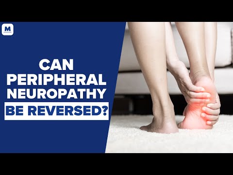 Can Peripheral Neuropathy Be Reversed | Diabetes Peripheral Neuropathy | Mastering Diabetes