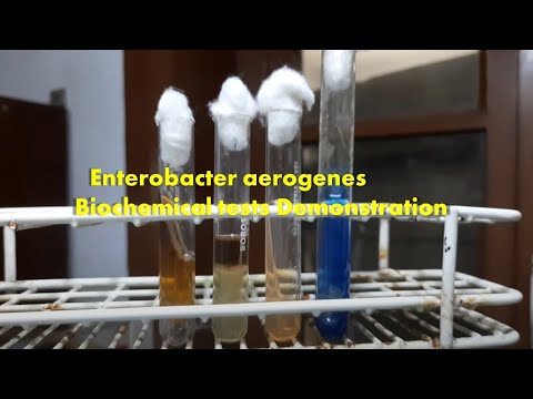 Enterobacter aerogenes Biochemical tests Demonstration