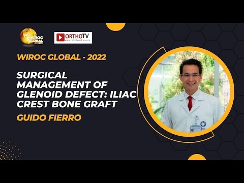Wiroc Global 2022 : Surgical management of Glenoid Defect: iliac crest bone graft - Guido Fierro