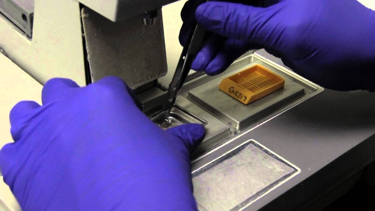 Histology: Embedding Process