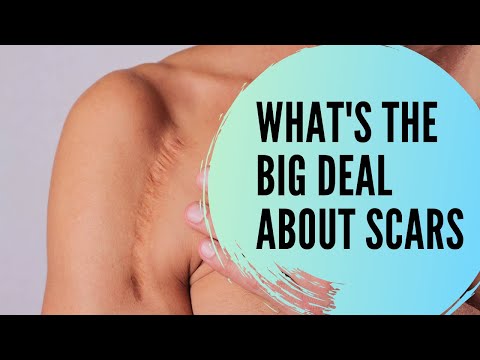 What's the Big Deal About Scar Tissue - How It Impacts the Body