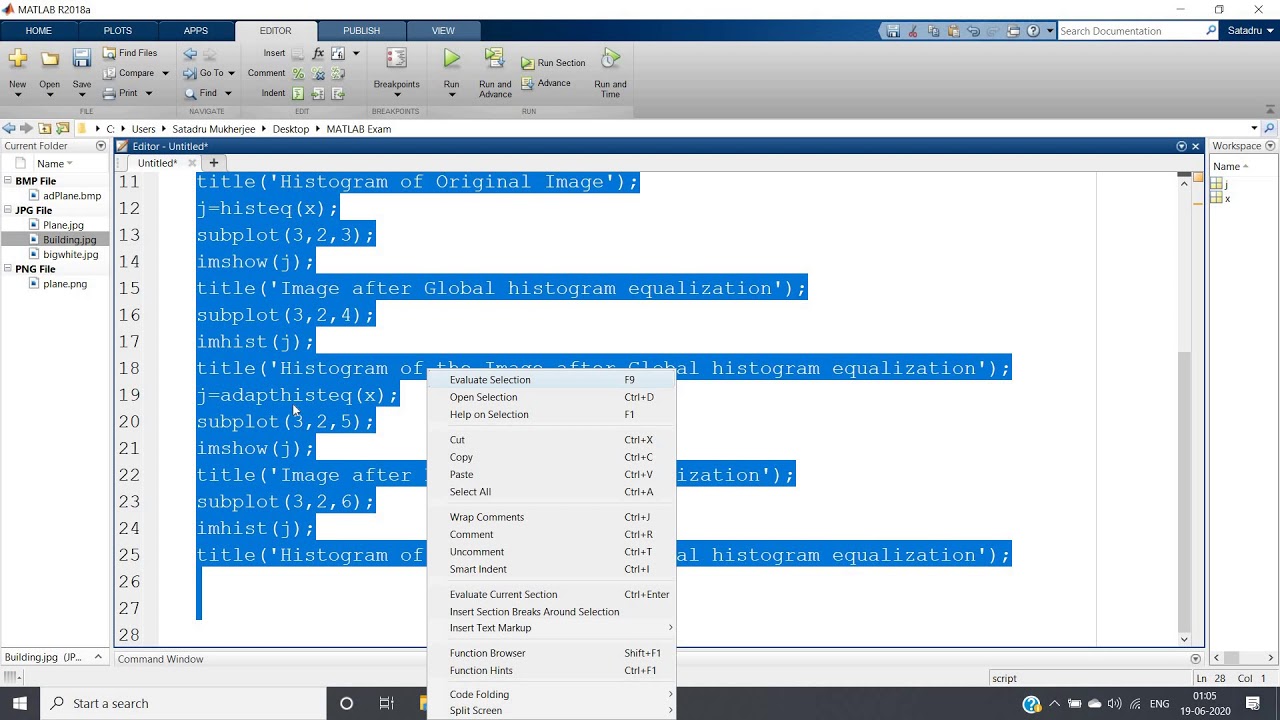 Adaptive histogram equalization | MATLAB