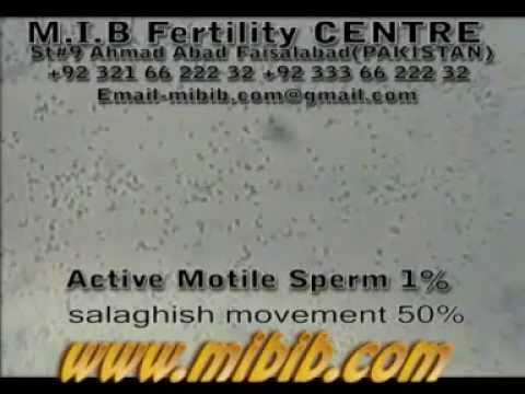 active motile sperm 1%, sluggish motile 50% video,low sperm count video