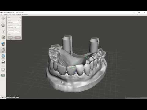 Creating supports in MeshMixer