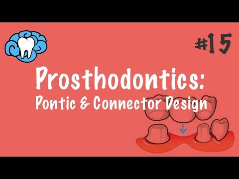 Prosthodontics | Pontic & Connector Design | INBDE, ADAT