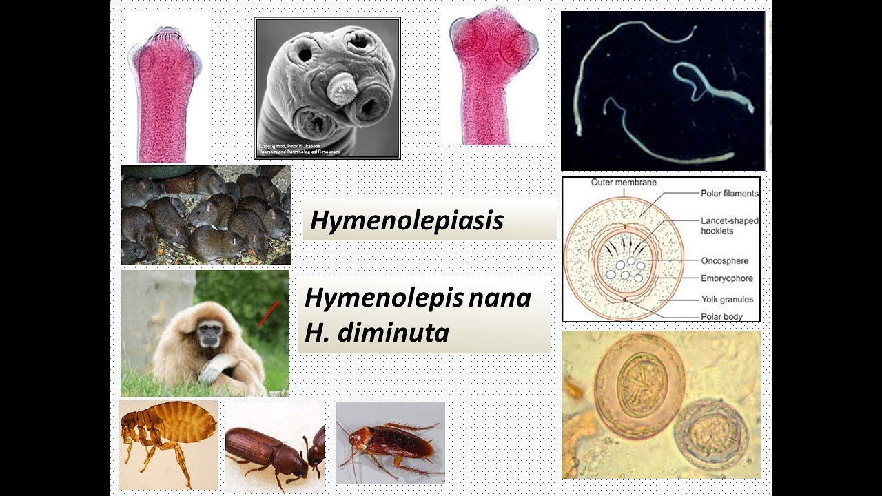 Hymenolepis nana/Hymenolepis diminuta infection or Hymenolepiasis in humans and rodents [A-Z]