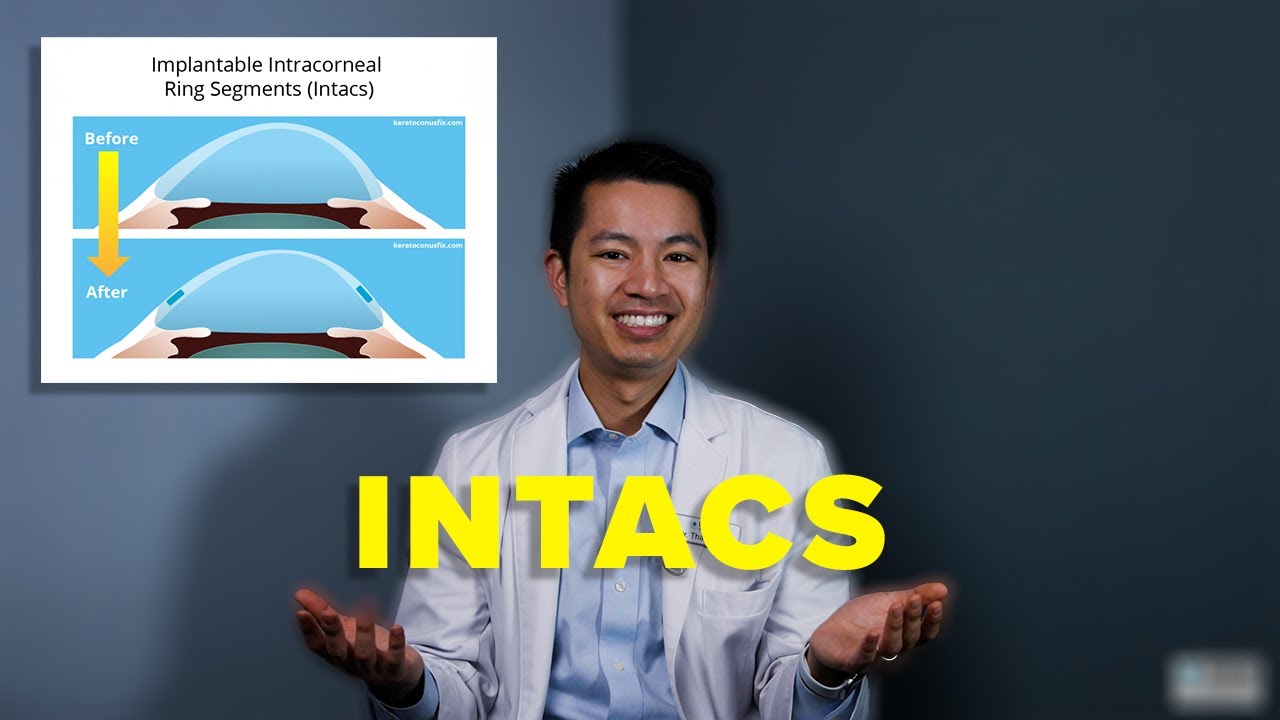 What Are Intacs And Is It Worth It?