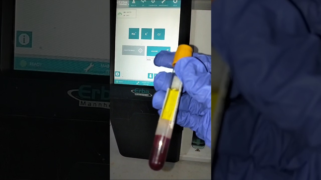 How to run a sample in EC 90 Analyzer