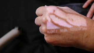 NextVein Handheld Vein Visualization Finder System V800NV