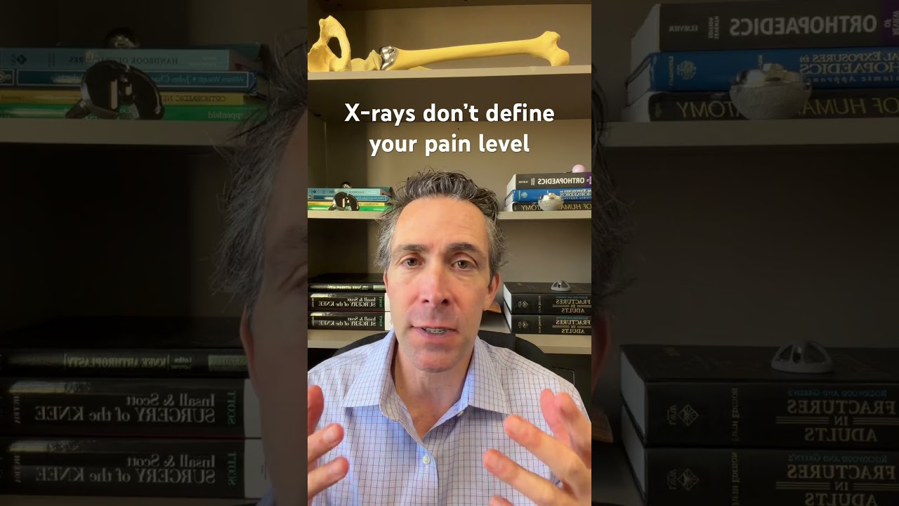 X-rays don’t define your arthritis pain