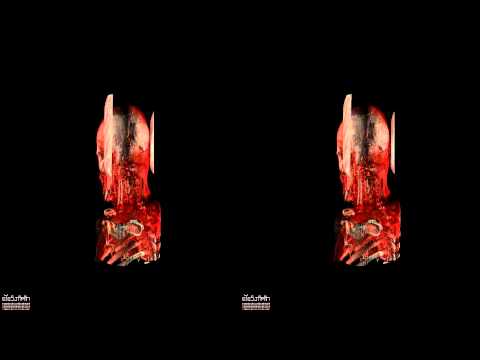 Angi 3D