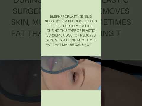 Blepharoplasty (eyelid surgery) is a procedure used to treat droopy eyelids. Subscribe for more