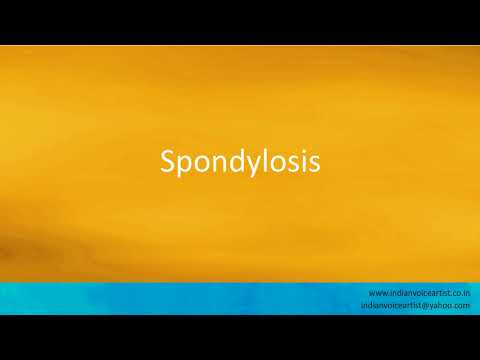 Pronunciation of the word(s) "Spondylosis".