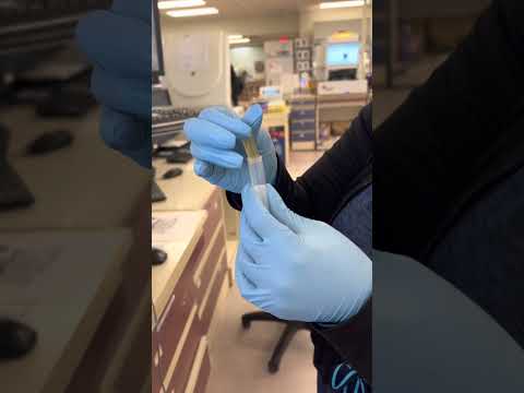 Beckman Coulter Access 2 Demo