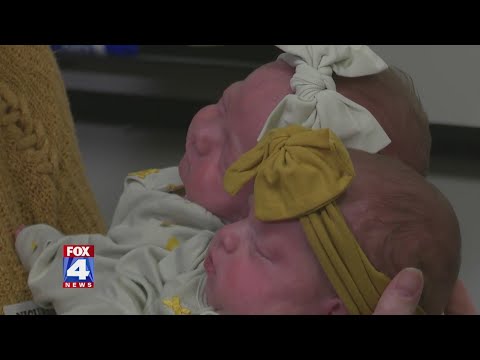 Rare 'MoMo' twins born at Overland Park Regional Medical Center
