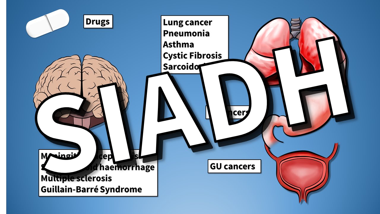 SIADH EXPLAINED (Hyponatraemia)