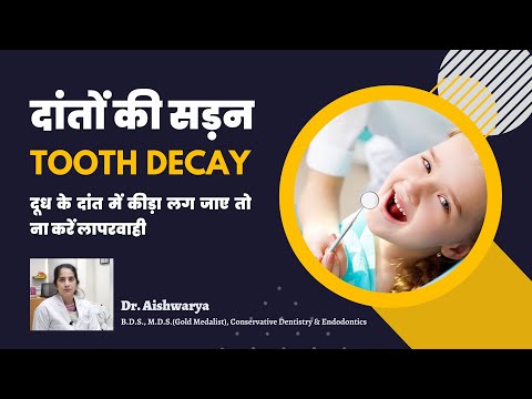 दांतों में सड़न क्यों होती है? | Tooth Decay In hindi | Tooth Cavity