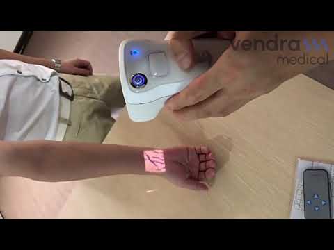 Vdetector P3 Arm veins
