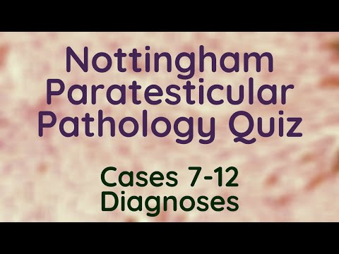 Paratesticular quiz diagnoses - Pathology mini tutorial