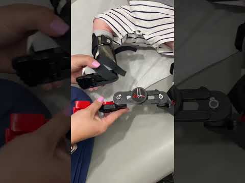 Quick release clubfoot brace #short #shortsvideo #shortsvideo #shorts #shortsfeed #shortsyoutube 