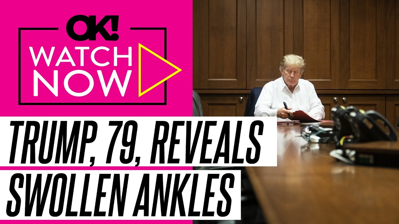 Donald Trump, 79, Puts Swollen Cankles on Display After Surprise Medical Trip