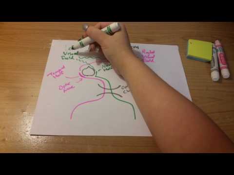 Module 6 - Optic Chiasm
