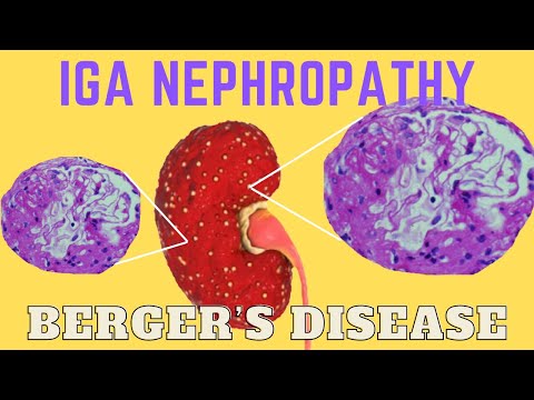 Is IgA Renal Disease Dangerous? How To Treat? - IgA Nephropathy (Berger’s disease) - 247nht