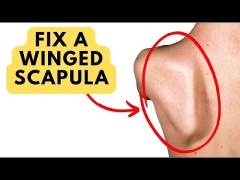 Severe Scapula Winging Revealed | Sports Injury & Long Thoracic Nerve ...