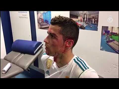 Inside the dressing room after Cristiano Ronaldo's injury