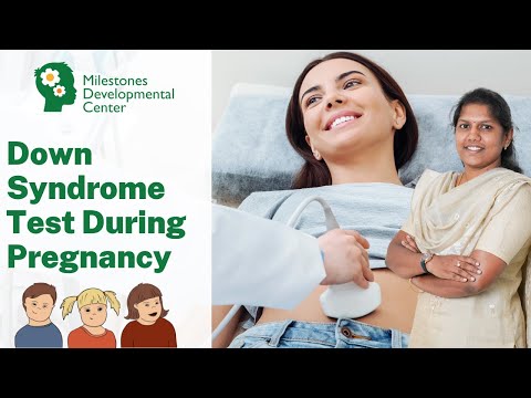 Down Syndrome test during pregnancy | Dr.Pavithra | Salem | Tamil