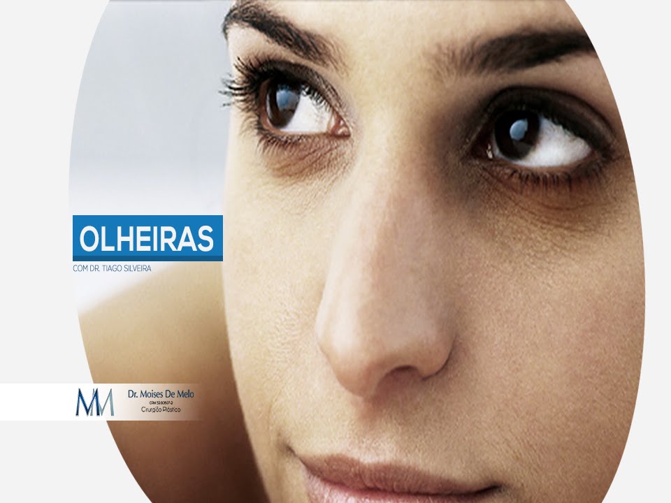 Dr. Moises De Melo | Olheiras com Dr. Tiago Silveira