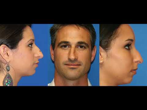 The Functional Nose by Dr. Amir Karam, Rhinoplasty Specialist in San Diego