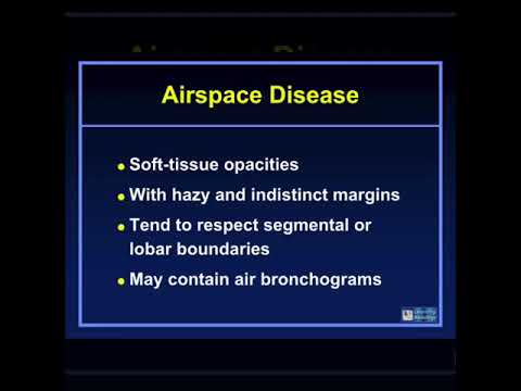 Recognizing interstitial versus airspace disease