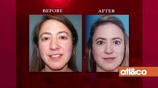 3 Best Plastic Surgeons in Atlanta, GA - Expert Recommendations