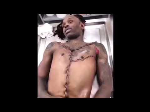 King Von’s Dead As Goofy, Sliced Body As Goofy, Wat U Need A Suite, BurnEazyGoofy😂😂On4Nem
